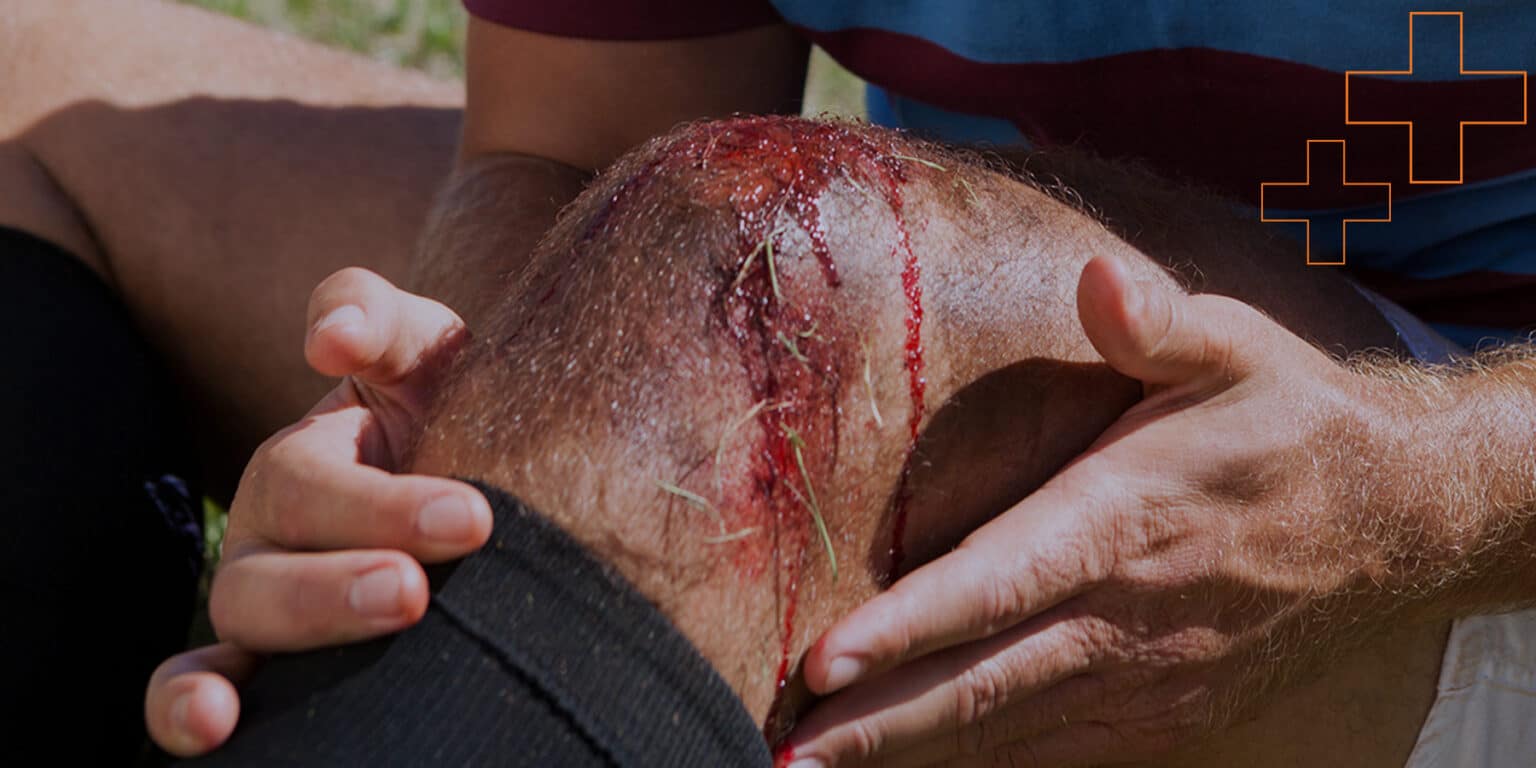 Turf Burn: The Athlete's Guide to Prevention and Treatment | DuraDerm SPORT